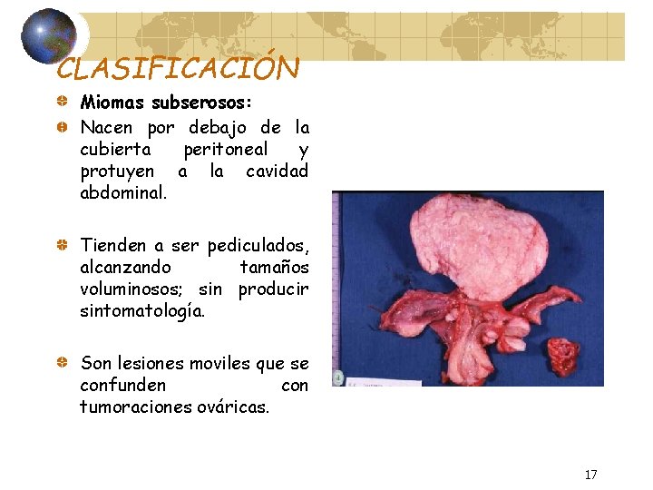 MIOMATOSIS UTERINA DR FRANCISCO DEL PALACIO GINECOLOGO Y