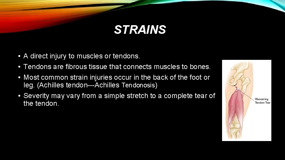 SPRAINS STRAINS COMMON ACUTE SOFTTISSUE INJURIES Andria Polo