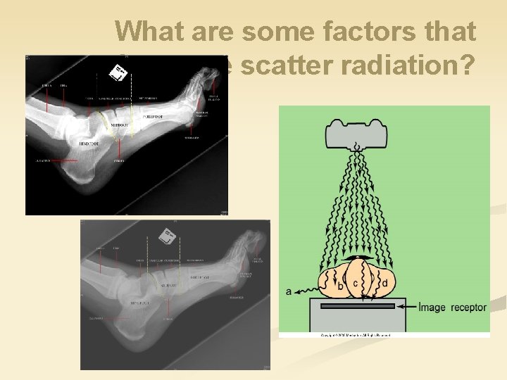 Control of Scatter Radiation Objectives Begin discussing factors