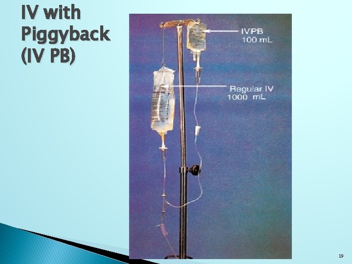 Intravenous Solutions Equipment and Calculations MAT 119 Chapter