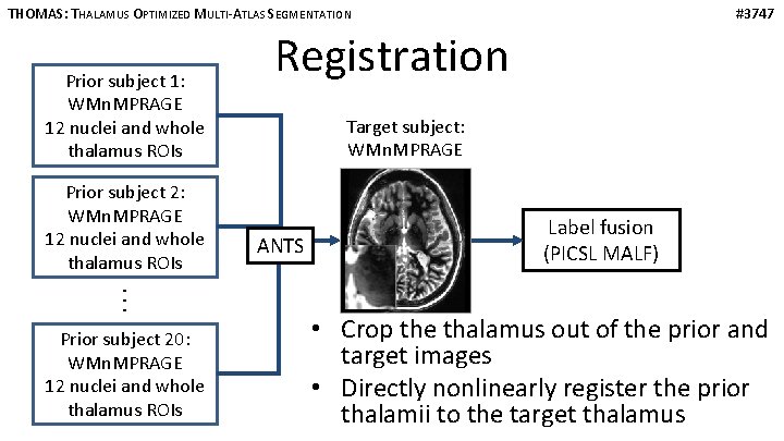 3747 THOMAS THALAMUS OPTIMIZED MULTIATLAS SEGMENTATION Jason Su
