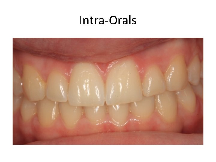 PHOTOGRAPH PROTOCOL A GUIDE FOR CLINICAL STAFF Indications