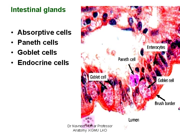 Histology of lower gastro intestinal tract By Navneet