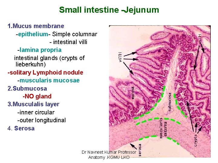 Histology of lower gastro intestinal tract By Navneet