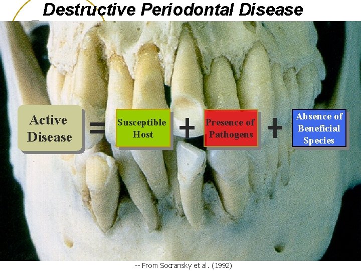 Dental Conference MID Periodontal Disease November 11 2004