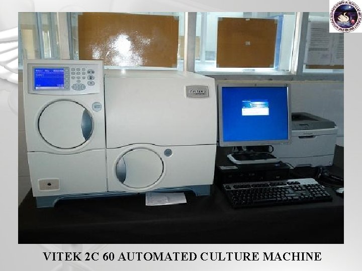 MALDI TOF analysis of Streptococcus pneumoniae from Cerebrospinal