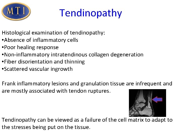 Tissue Specific Exercises Tendon Tendinopathy Strong evidence exists