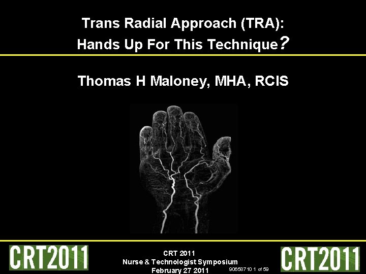 Trans Radial Approach TRA Hands Up For This