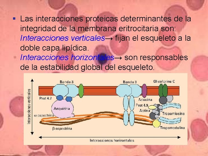 ESFEROCITOSIS HEREDITARIA PRACTICAS DIRIGIDAS II LIC HECTOR PARADA