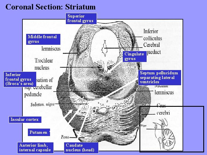 Sectional Anatomy of the Brain Dr G R