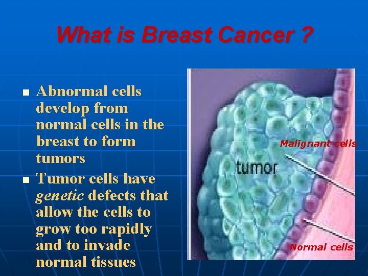What is Breast Cancer n n Abnormal cells