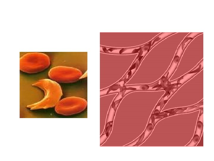 Gene Mutations 5 year old boy with genetic