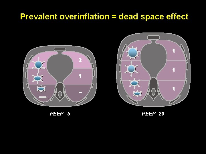 Ventilation strategies targets and goals in acute respiratory