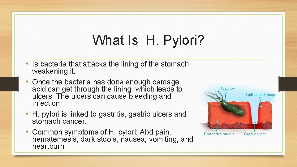 PPIs and H Pylori By Julie Fitzwilliam Zara
