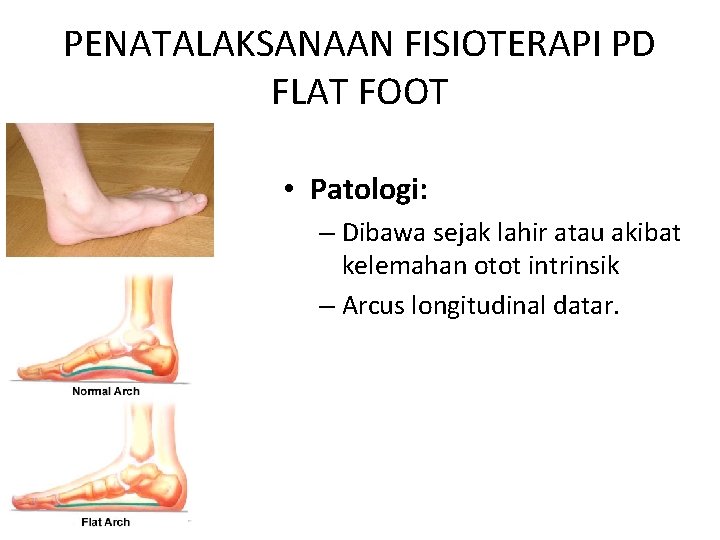 PENATALAKSANAAN FISIOTERAPI REGIO ANKLE AND FOOT Oleh Sugijanto