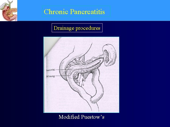 Chronic Pancreatitis Management Strategies Dr Vidhyachandra Gandhi DNB