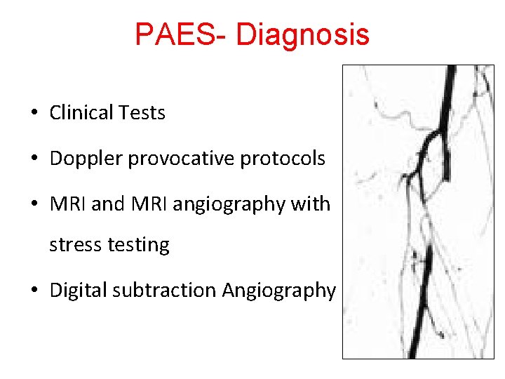 Popliteal artery Entrapment Syndrome Sachin Khullar PAES Some