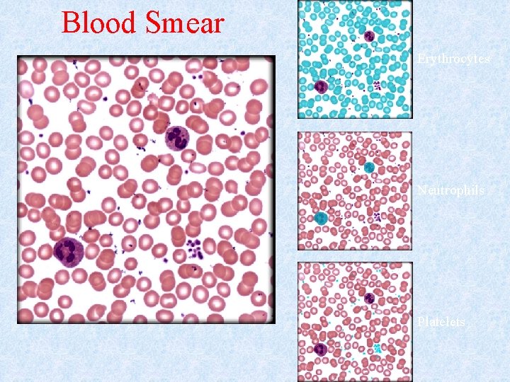 Chapter 12 Blood 12 1 Blood Smear Erythrocytes