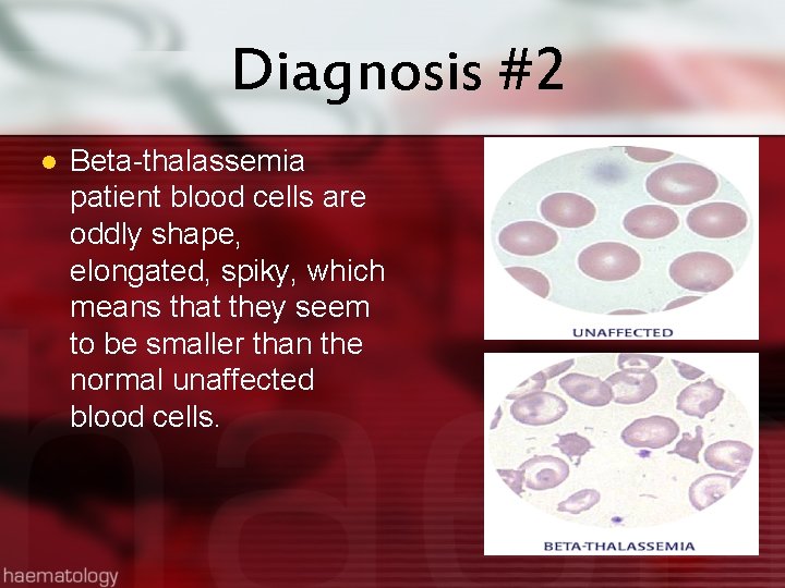 Beta thalassemia Presented by Kenneth B Neebani What