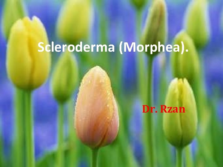 Scleroderma Morphea Dr Rzan Objectives 1 define Identify