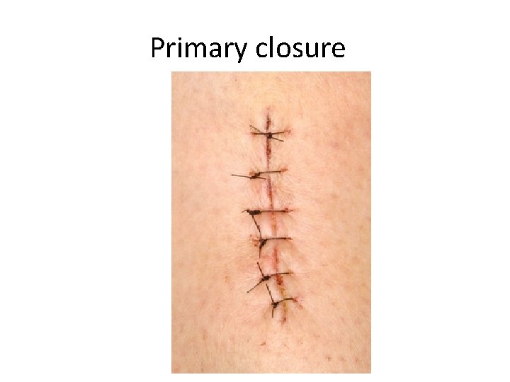 Plastic and reconstructive surgery Dr Yaseen Abdullah Plastic