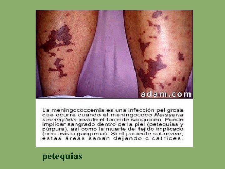 Microbiologa Clnica Familia Neisseriaceae Morfologa Las bacterias de