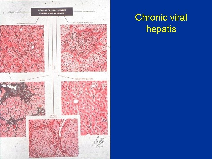 PATHOLOGY OF THE LIVER VII practical training 3