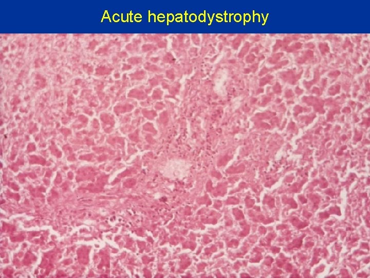 PATHOLOGY OF THE LIVER VII practical training 3