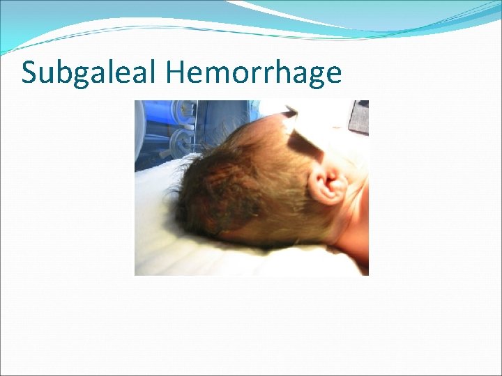 Neonatal Shock Sneha Sood MD Objectives To discuss