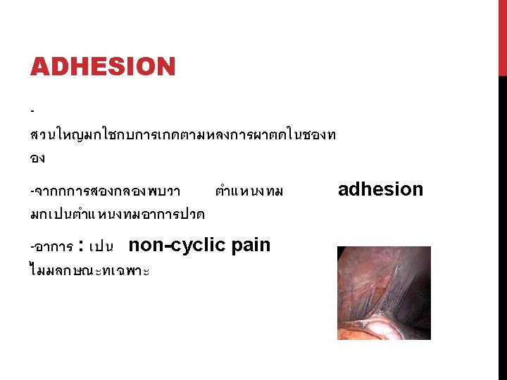 APPROACH TO ABDOMINAL PAIN Facilitator Pawin Puapornpong LODCRAFT