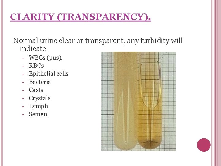 URINE ANALYSIS Dr Ola Samir Ziara Modified by