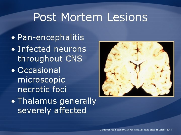Japanese Encephalitis Japanese B Encephalitis Arbovirus B Overview
