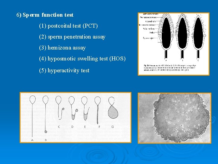 Male infertility Male infertility Reproductive medicine has undergone