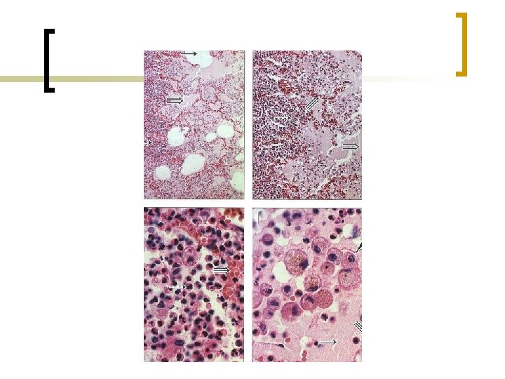 Violation of blood circulation hyperaemia anaemia stasis bleeding