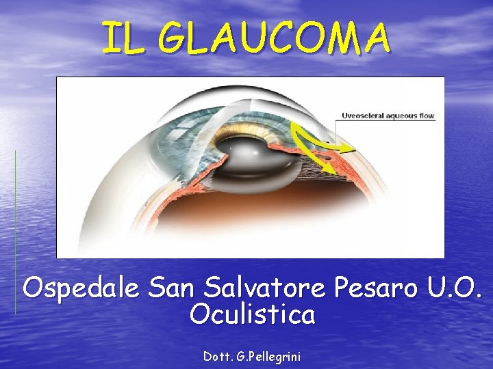 IL GLAUCOMA Ospedale San Salvatore Pesaro U O
