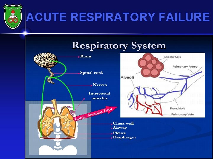 ACUTE RESPIRATORY FAILURE Definitions Hypoxemia is reduction in