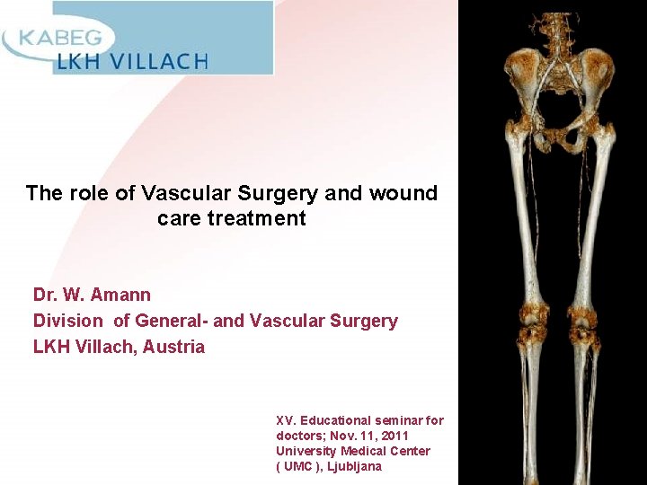 The role of Vascular Surgery and wound care