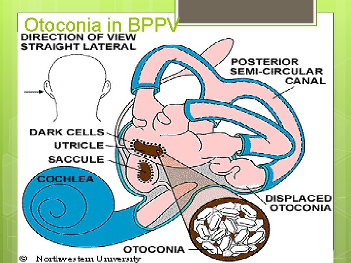 Dizziness and Vertigo V Abbasi M D Dizziness