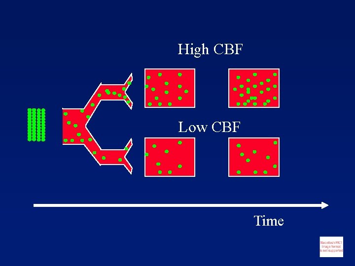 Perfusion f MRI Brain Function and f MRI