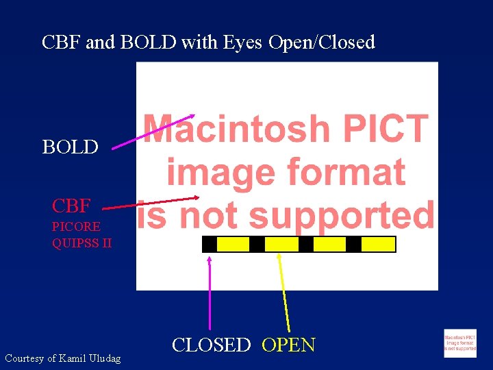Perfusion f MRI Brain Function and f MRI