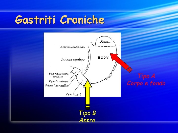 Anatomia dello stomaco Fondo Cardias Zona oxintica Piloro