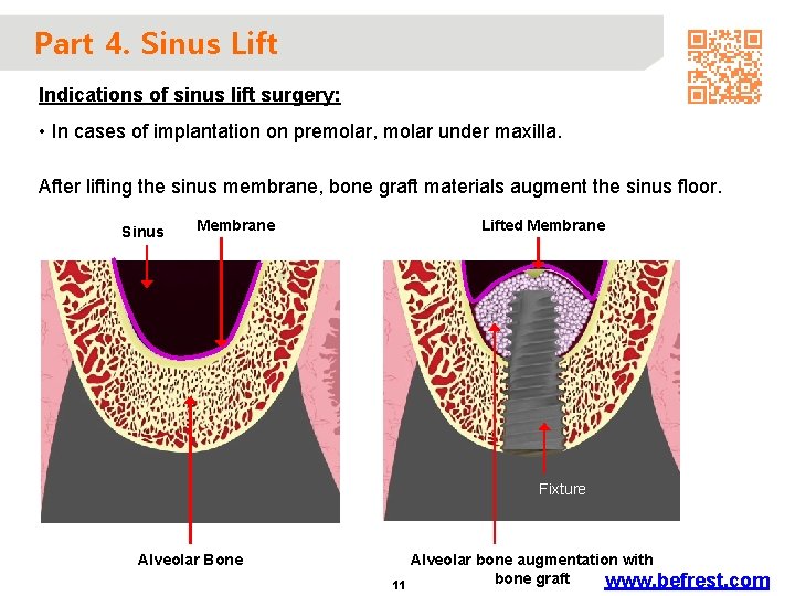 v Basic Course Understanding of sinus surgery Slides