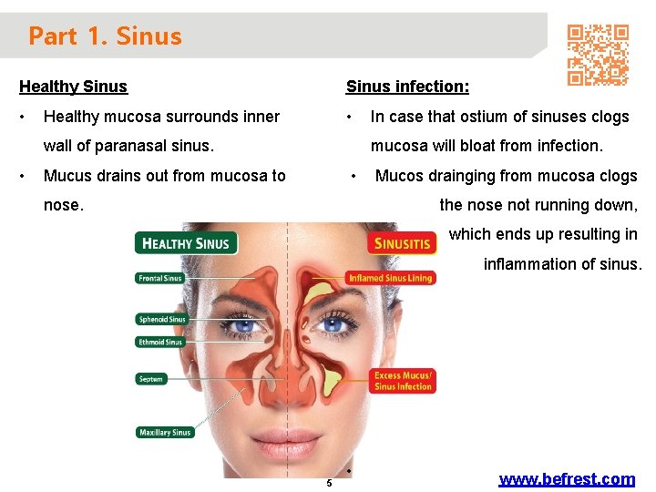v Basic Course Understanding of sinus surgery Slides