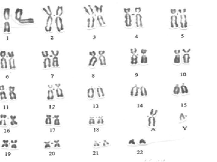Les chromosomes I Structure des chromosomes humains ADN