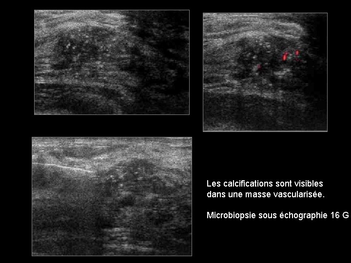 Observations radiocliniques 42 ans Opre 5 ans avant