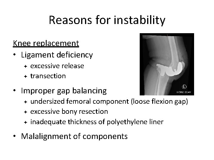 The Unstable Knee De Juan Ng Reasons for