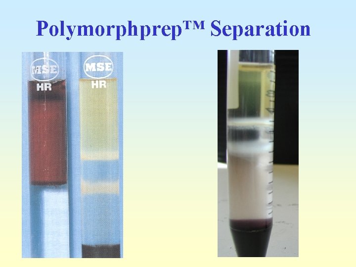 Purification of cells from human peripheral blood Mononuclear