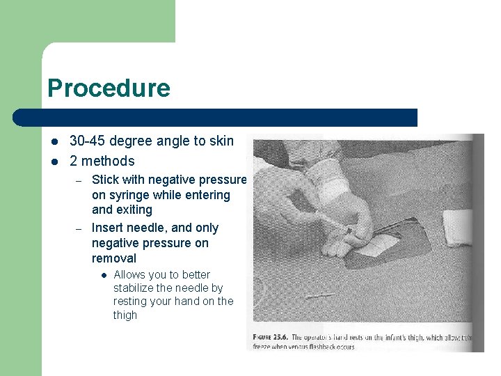 Venous Access Matthew L Paden MD Emory University