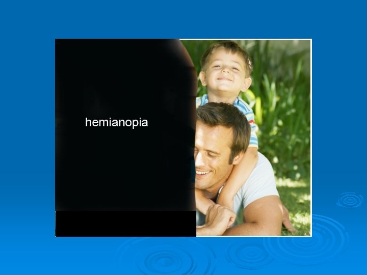 Percepcija i perceptivni deficiti Katedra za zdravstvenu psihologiju