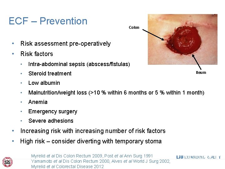 SNAP How to treat enterocutaneous fistulas Oslo March